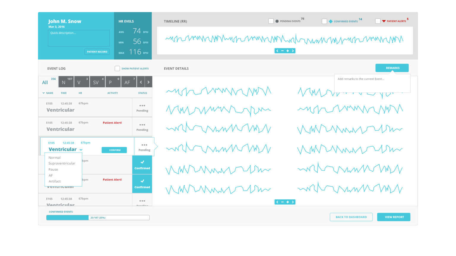 Heart - Spark Works Ltd